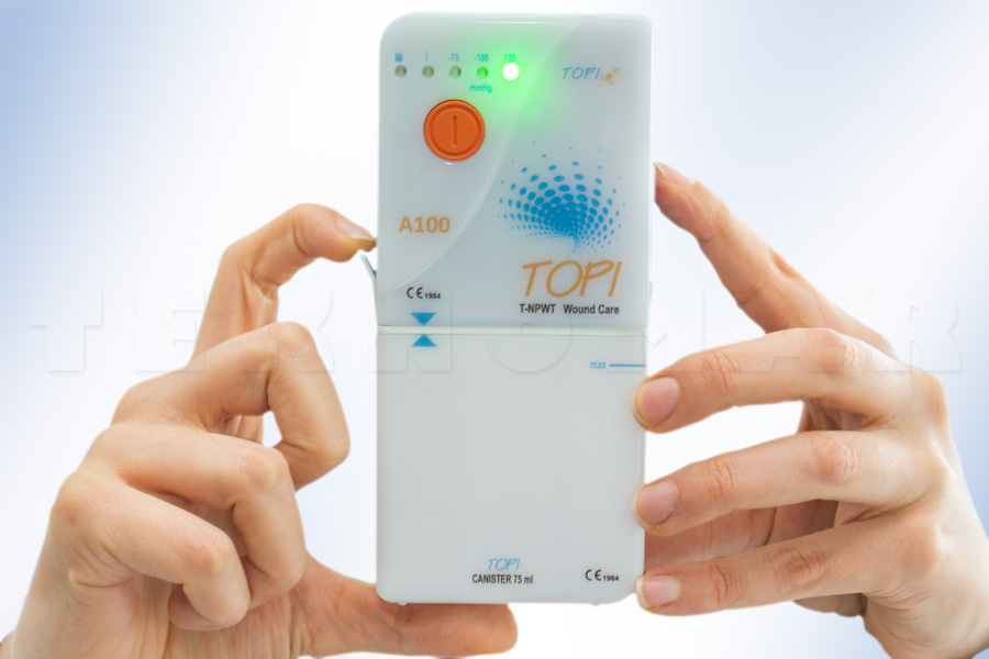 Topi A100 Mobile Disposable Classic NPWT Vacuum Assisted Wound Care ...